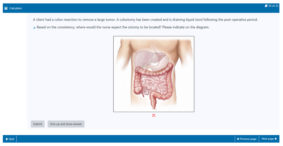 NCLEX Question Types – NurseAchieve
